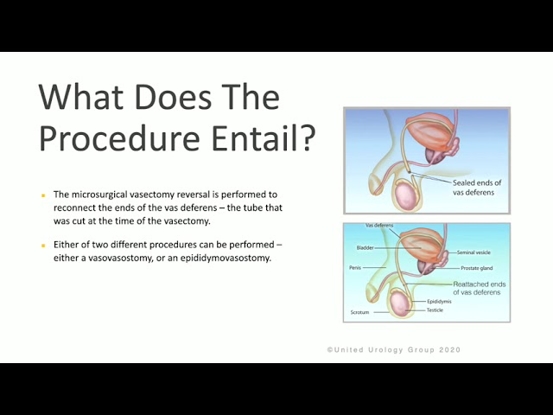Adult Circumcision United Urology
