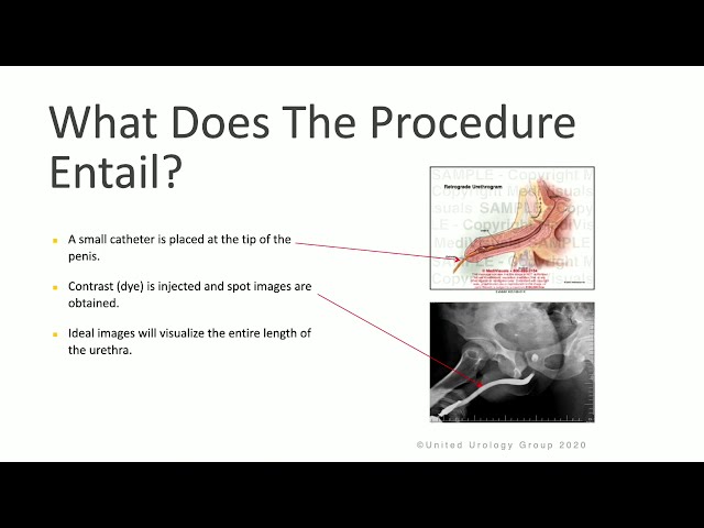 Retrograde Urethrogram & voiding Cystourethrogram | United Urology Retrograde Urethrogram & voiding Cystourethrogram | United Urology