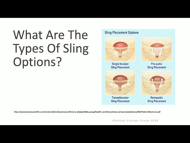 Mid Urethral Sling For Stress Urinary Incontinence In Women United